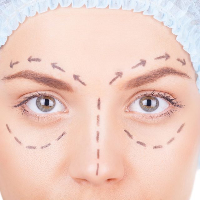10 Eye-Opening Facts About Blepharoplasty – Bright Blepharoplasty Choice